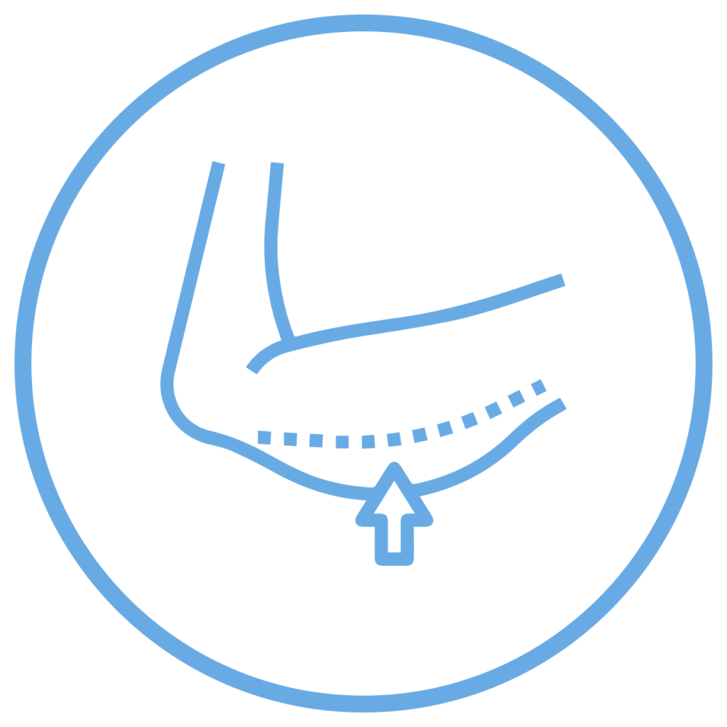 最強收副乳方案 全港首創美胸服務 – Hafina